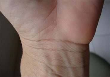 Count The Bracelet Lines on Your Wrist! How Many do You Have? Here's ...