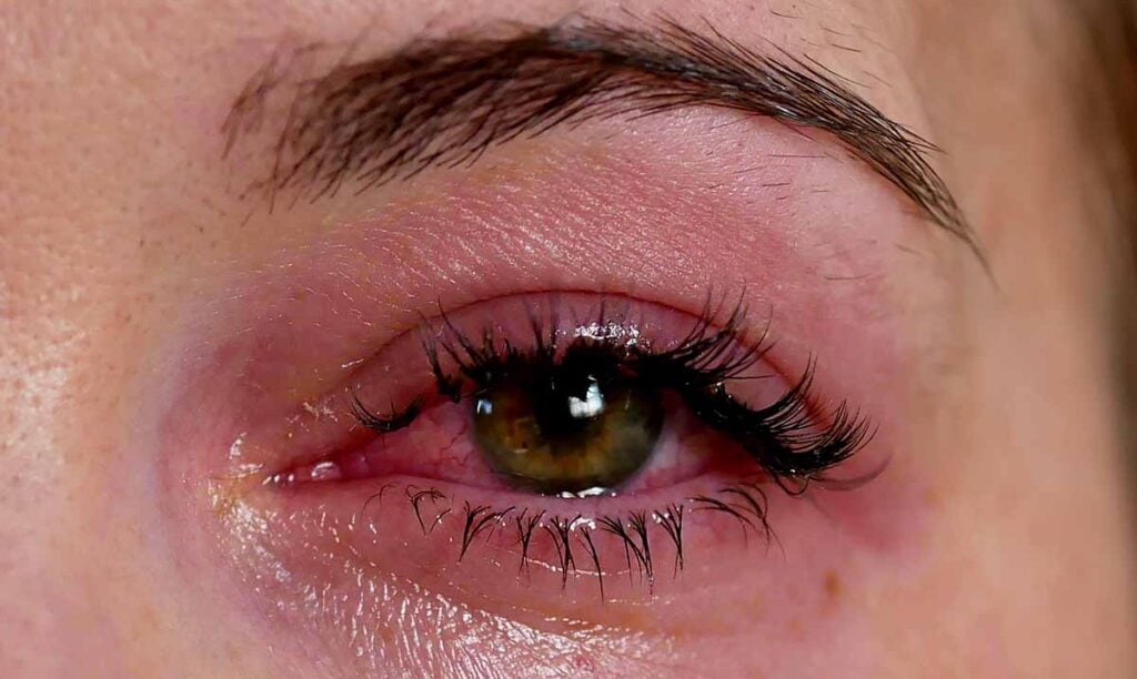 11 Strange Things That Happen When You Are Stressed For Too Long ...