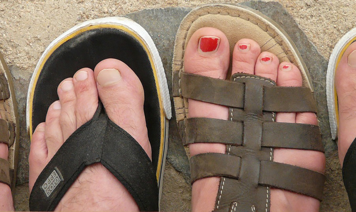 7 Reasons Why You Should Never Wear Flip-flops Again – Awareness Act