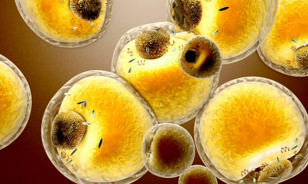 Scientists Successfully Turn Breast Cancer Cells Into Fat Cells To Stop ...