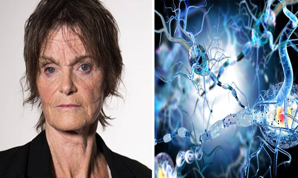 Meet The Cambridge Scientists Working To Cure Multiple Sclerosis ...