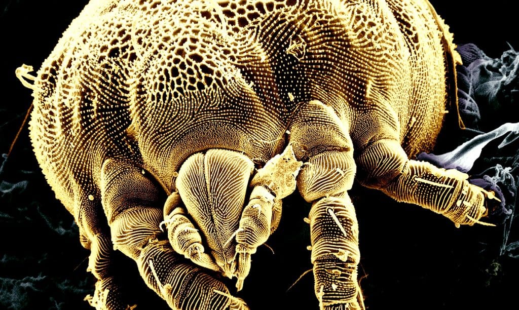 If You Ever Feel Lonely Remember This Mite Is Living On Your Face Right ...