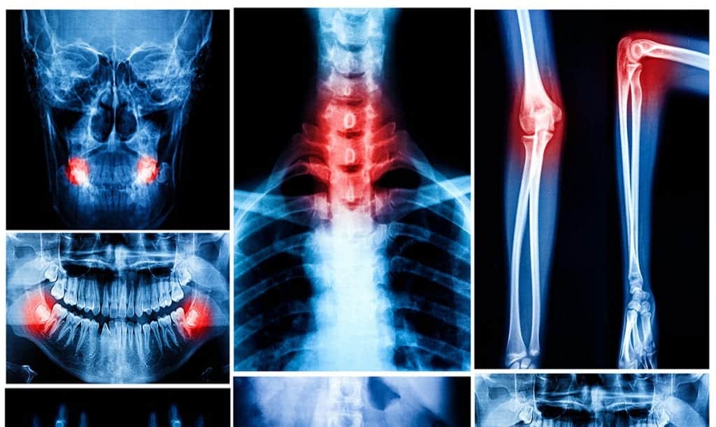 Emotional Muscle Memory: Releasing The Painful Emotions Trapped Within ...