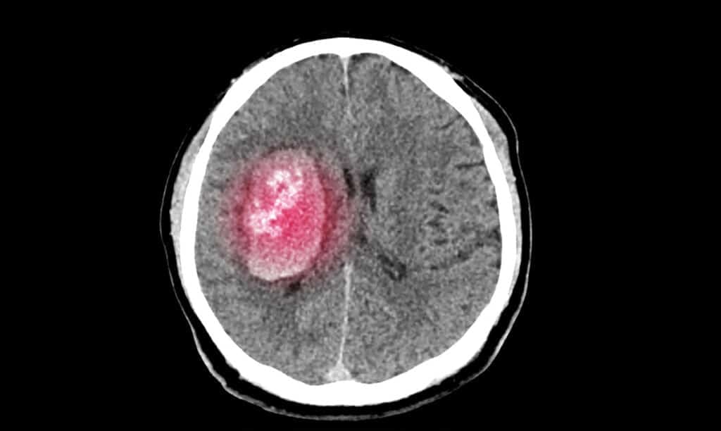 Science Confirms Our Life Really Does Flash Before Your Eyes Before ...